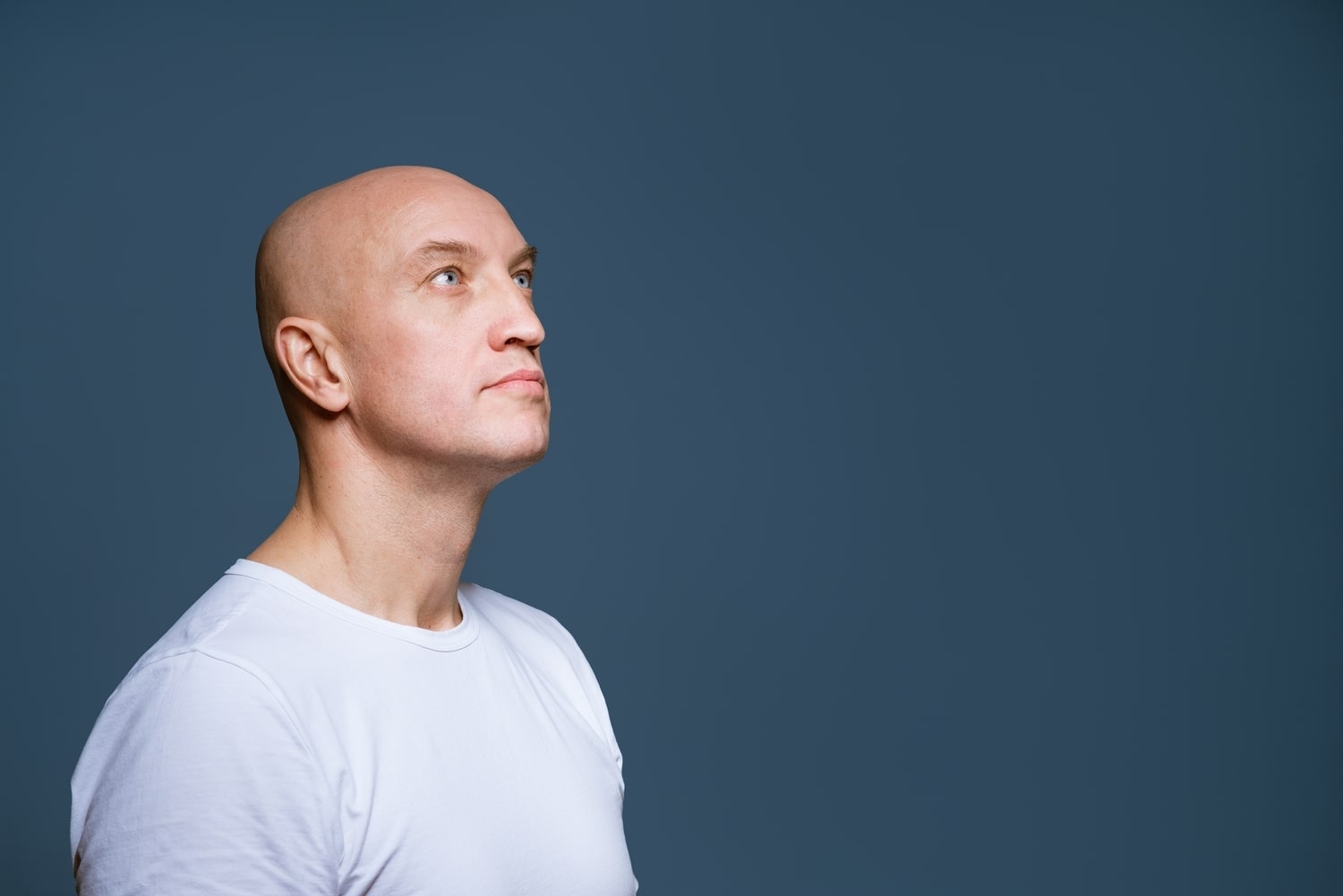 Alopecia Universalis: Definition, Symptoms, and Diagnosis - Dr Serkan ...