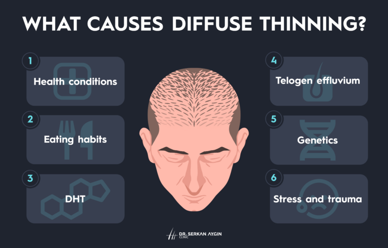 Diffuse Thinning Hair Transplant: Procedure, Results & Permanence - Dr ...