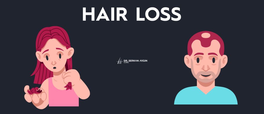Hair Loss Types Symptoms Causes And Treatments Dr Serkan Aygin Clinic