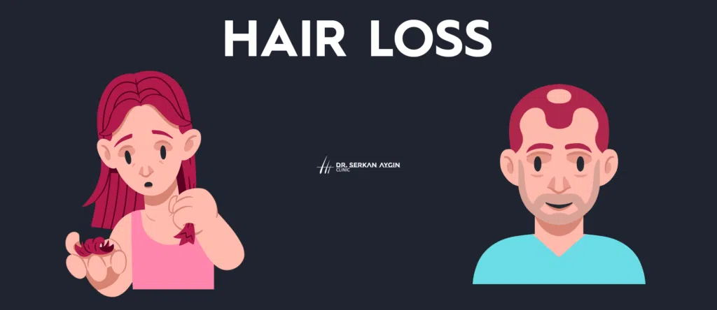 Hair Loss Types Symptoms Causes And Treatments Dr Serkan Aygin Clinic